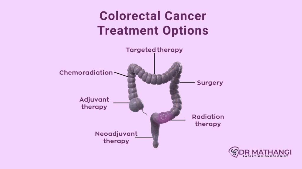 Colorectal Cancer Treatments – Dr. Mathangi J