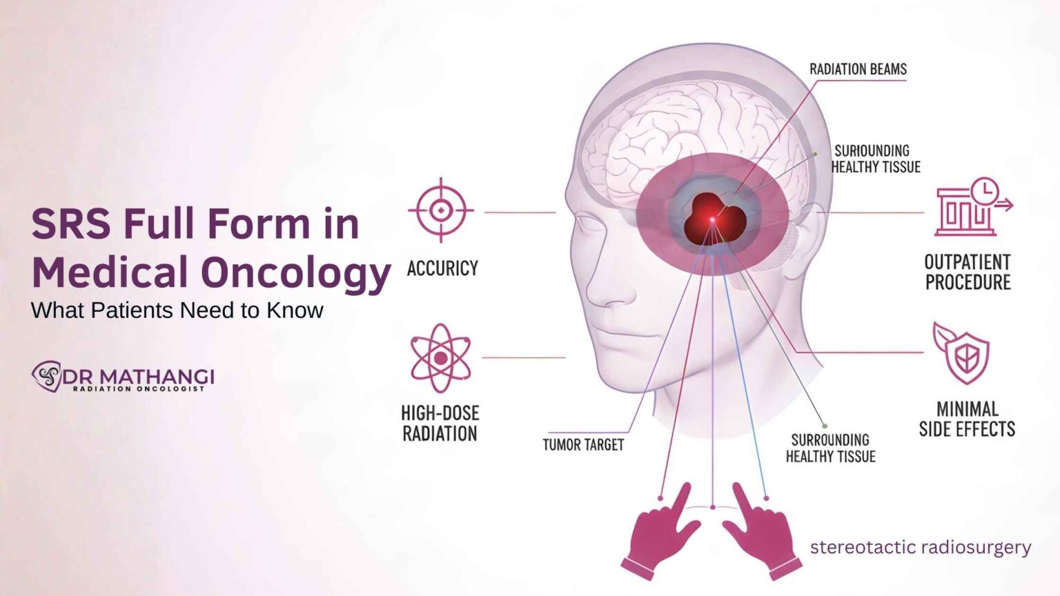 SRS Full Form in Medical Oncology – Dr. Mathangi J